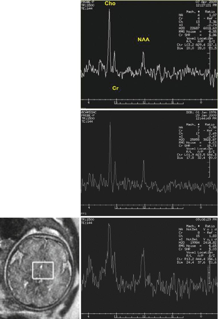 Current Techniques and Future Directions for Fetal MRI - MRI of Fetal ...