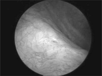 Urogenital problems - Hunt & Marshall's Clinical Problems in Surgery, 2 Ed.