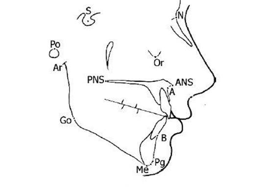 Radiographic Analysis and Imaging - Fundamentals Of Orthognathic ...