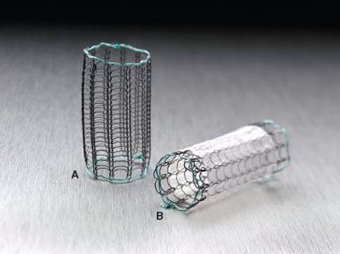 Airway Stenting - Master Techniques in Surgery: Thoracic Surgery: Lung ...