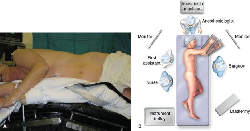Right Lower Lobe: VATS - Master Techniques in Surgery: Thoracic Surgery ...