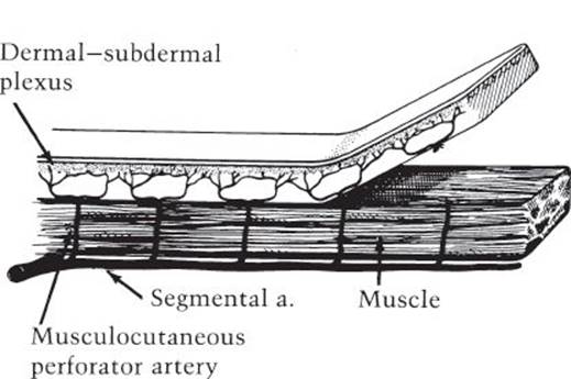 Flaps - Michigan Manual of Plastic Surgery (Lippincott Manual Series ...
