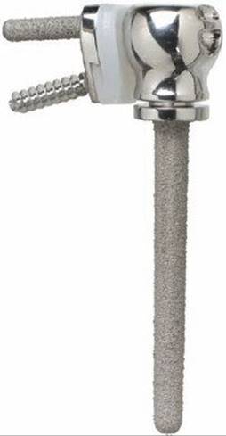 Ulnar Head Implant Arthroplasty - HAND, WRIST, AND FOREARM - Operative ...