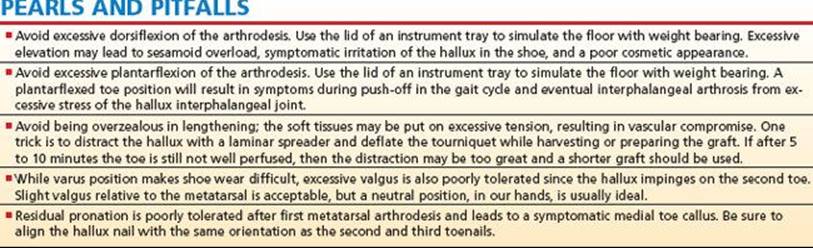 Bone-Block Distraction of the First Metatarsophalangeal Joint - FOOT ...