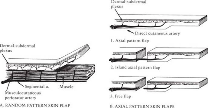 TECHNIQUES AND PRINCIPLES IN PLASTIC SURGERY - Grabb and Smith's ...