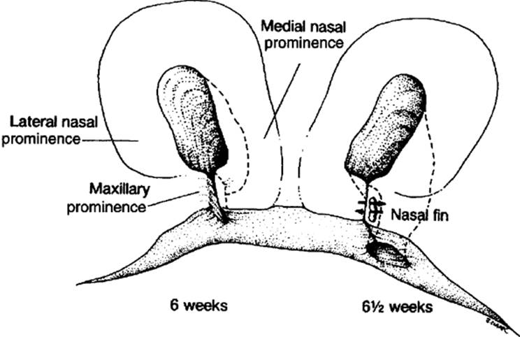 Formation of the Primary Palate - Cleft Lip & Palate: From Origin to ...