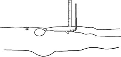 Important Intensive Care Procedures - Civetta, Taylor, & Kirby's ...