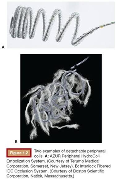Brief History and Classification of Embolic Agents - Embolic Materials ...