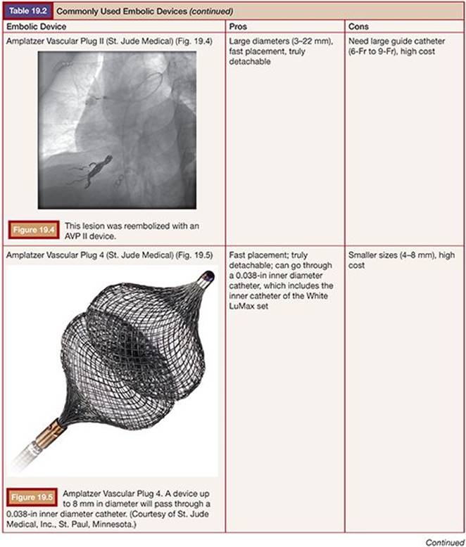 Pulmonary Arteriovenous Fistulas - Clinical Applications - Embolization ...