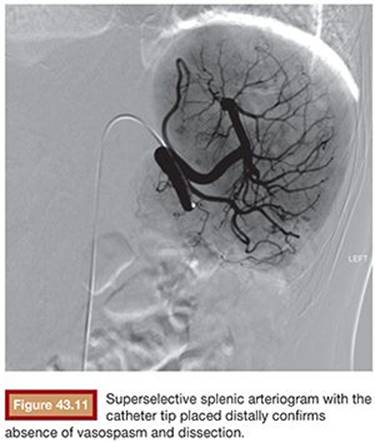 Hepatopancreatic Disease - Clinical Applications - Embolization Therapy ...