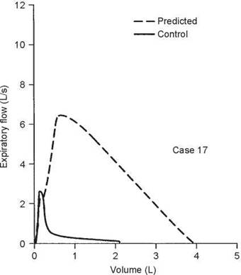 Illustrative Cases - Interpretation of Pulmonary Function Tests A ...