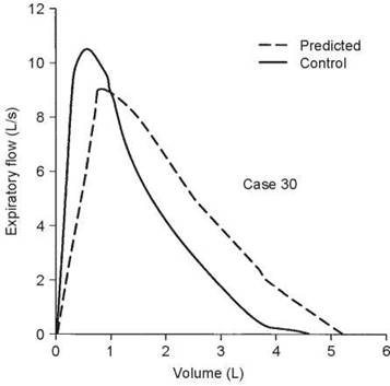 Illustrative Cases - Interpretation of Pulmonary Function Tests A ...