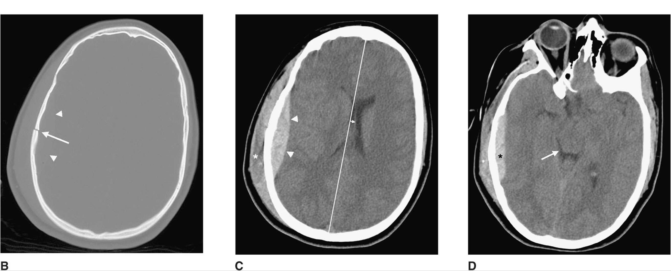 Diagnostic and Interventional Radiology - Trauma, 7th Ed.