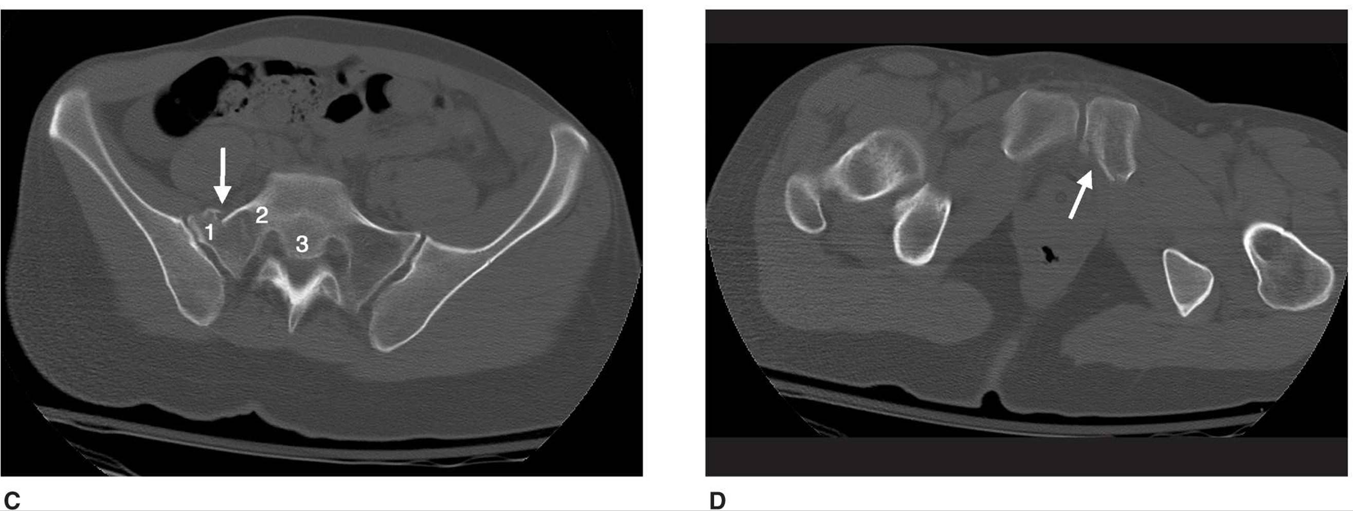 Diagnostic and Interventional Radiology - Trauma, 7th Ed.