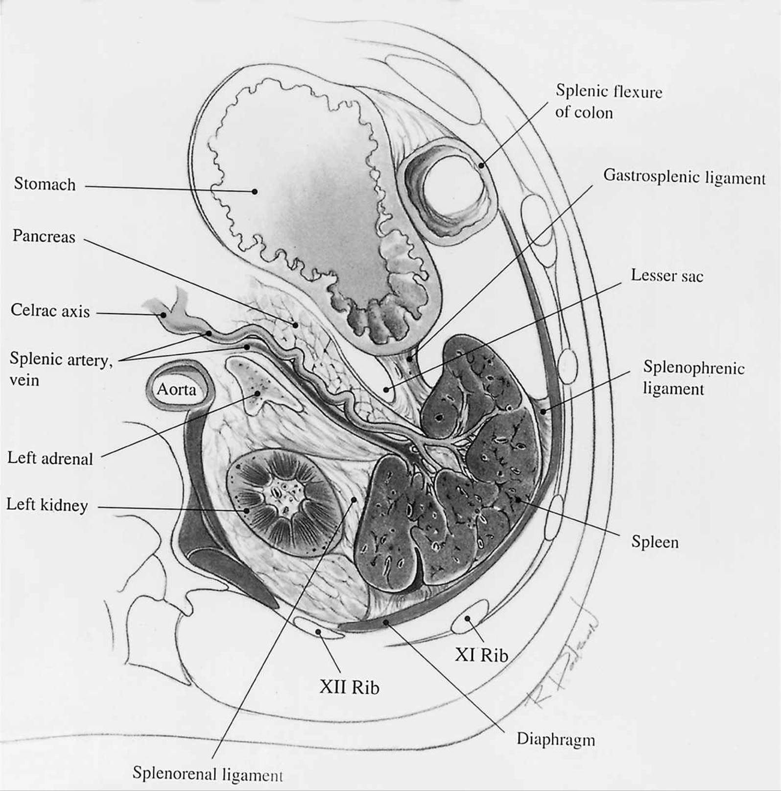 Injury to the Spleen - Trauma, 7th Ed.
