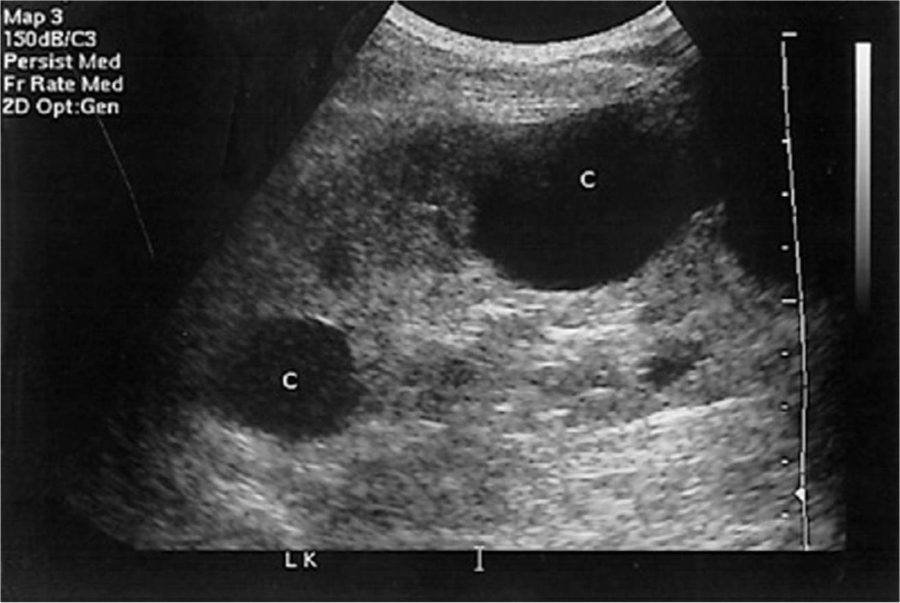 Questions 4 - Lange Review Ultrasonography Examination, 4th Edition