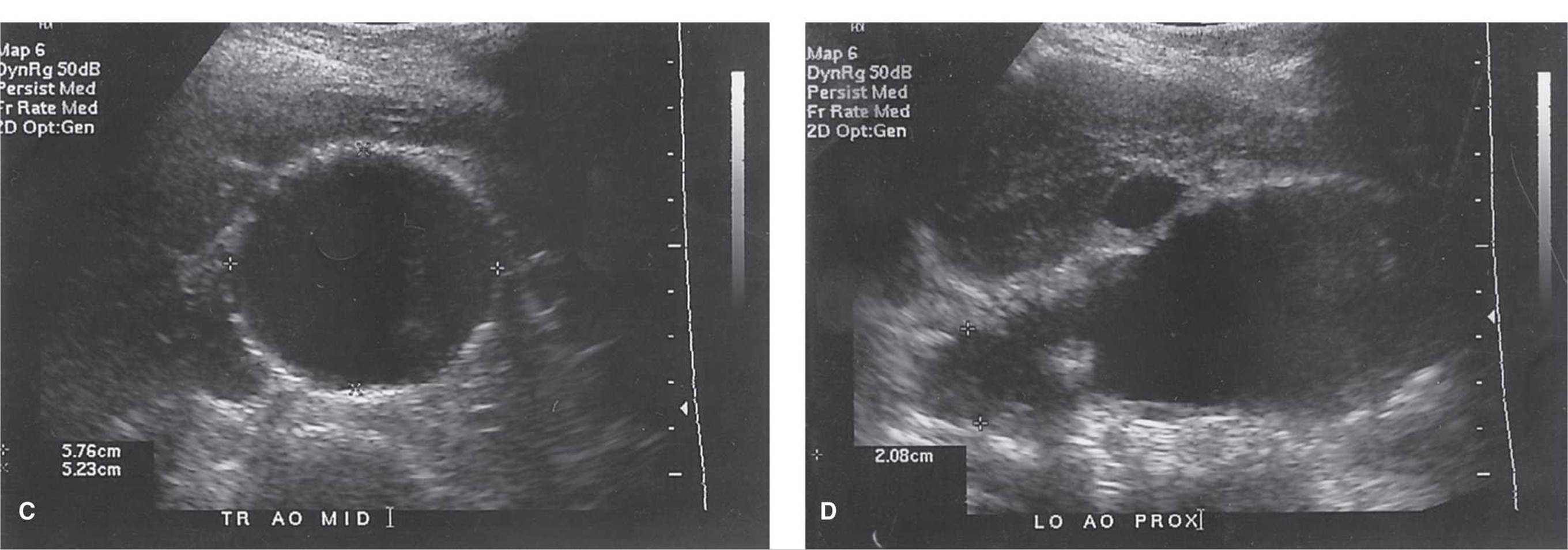 Questions 4 - Lange Review Ultrasonography Examination, 4th Edition
