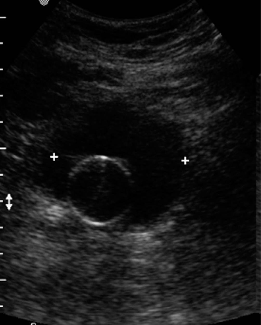Questions 4 - Lange Review Ultrasonography Examination, 4th Edition