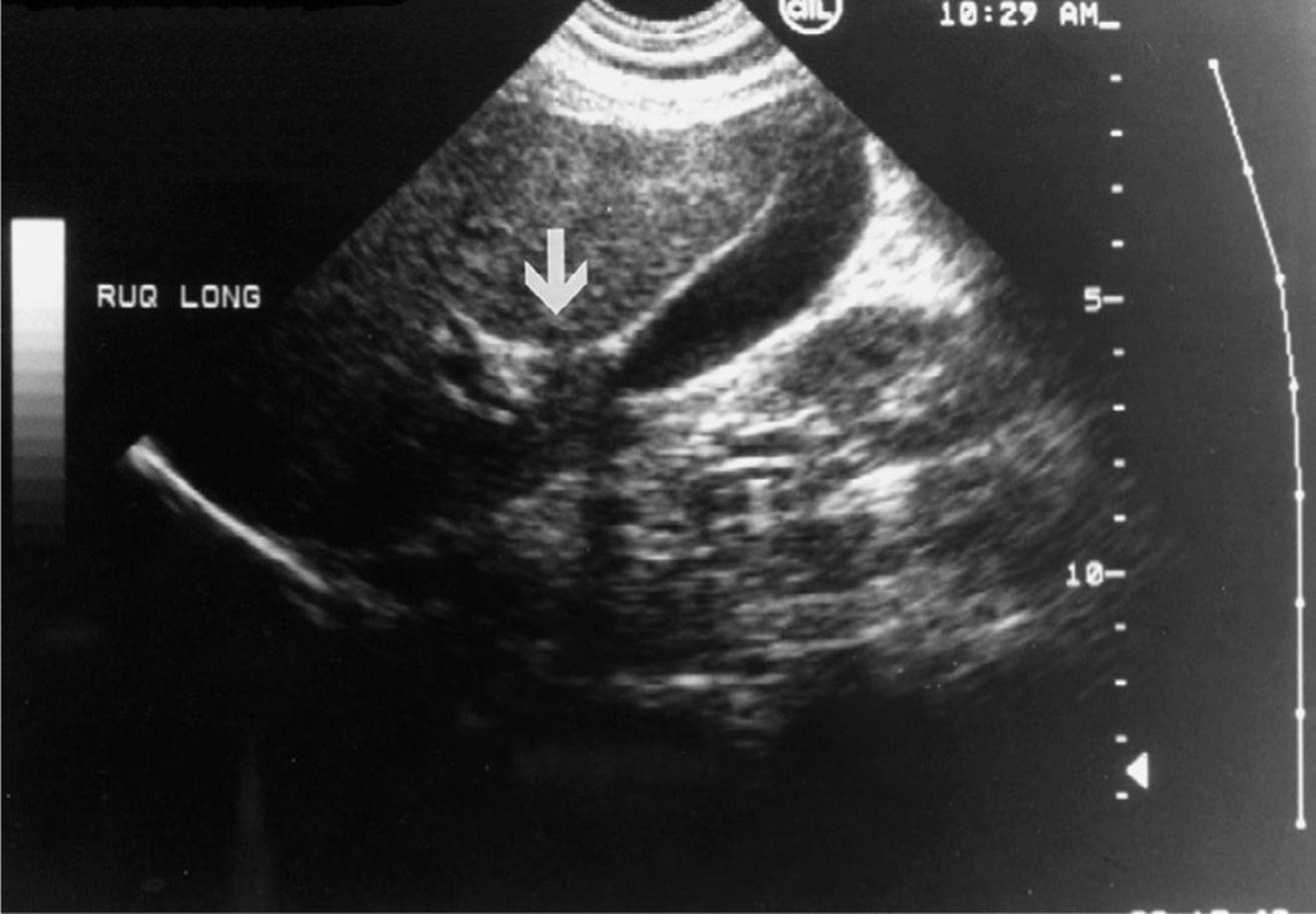 Questions 4 - Lange Review Ultrasonography Examination, 4th Edition