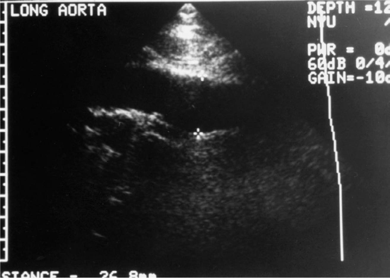 Questions 4 - Lange Review Ultrasonography Examination, 4th Edition