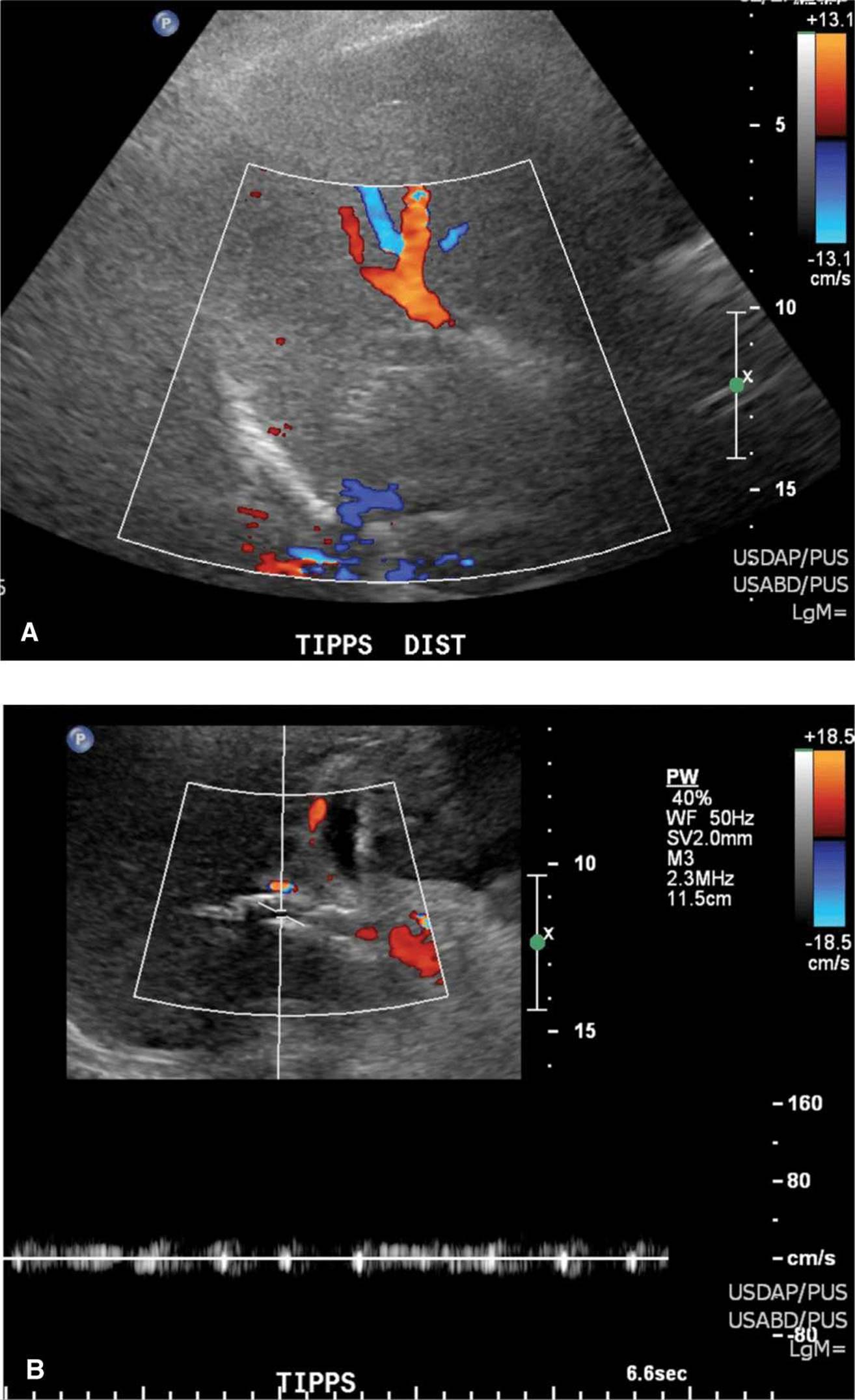 Case Studies 4 - Lange Review Ultrasonography Examination, 4th Edition
