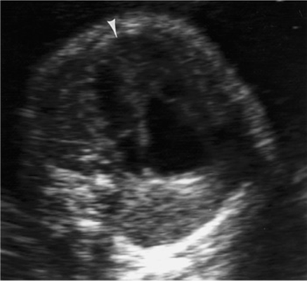 Fetal Echocardiography - Lange Review Ultrasonography Examination, 4th ...