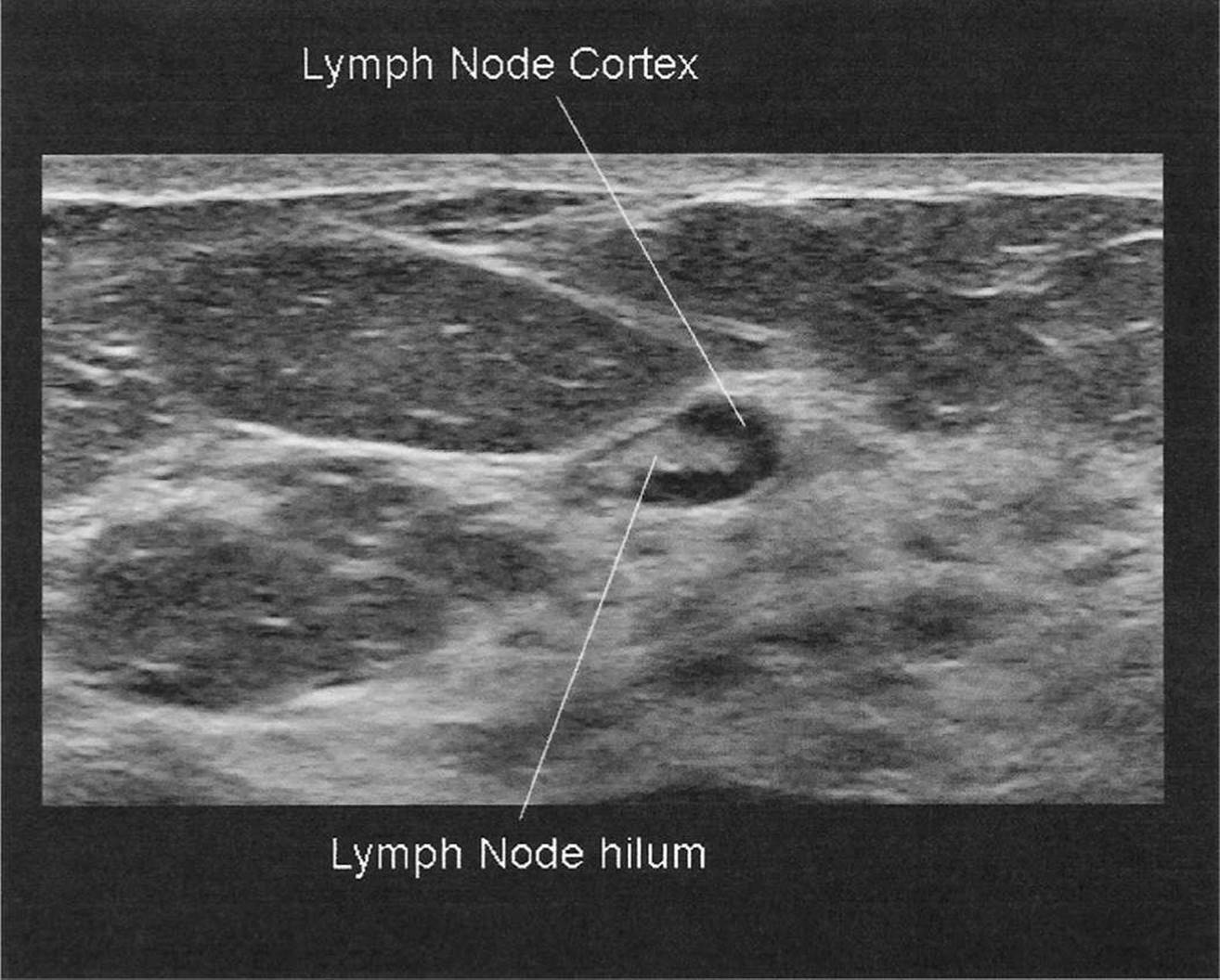 Breast Sonography - Lange Review Ultrasonography Examination, 4th Edition