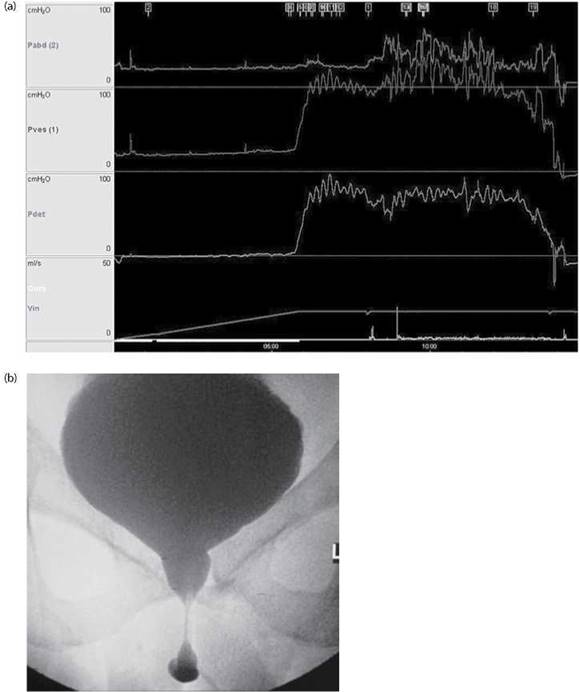 Neurourology - Female Urology And Neurourology - Viva Practice for the ...